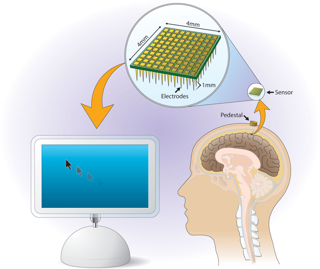 With Robot Arm, BrainGate Turns Thoughts into Action - Massachusetts ...